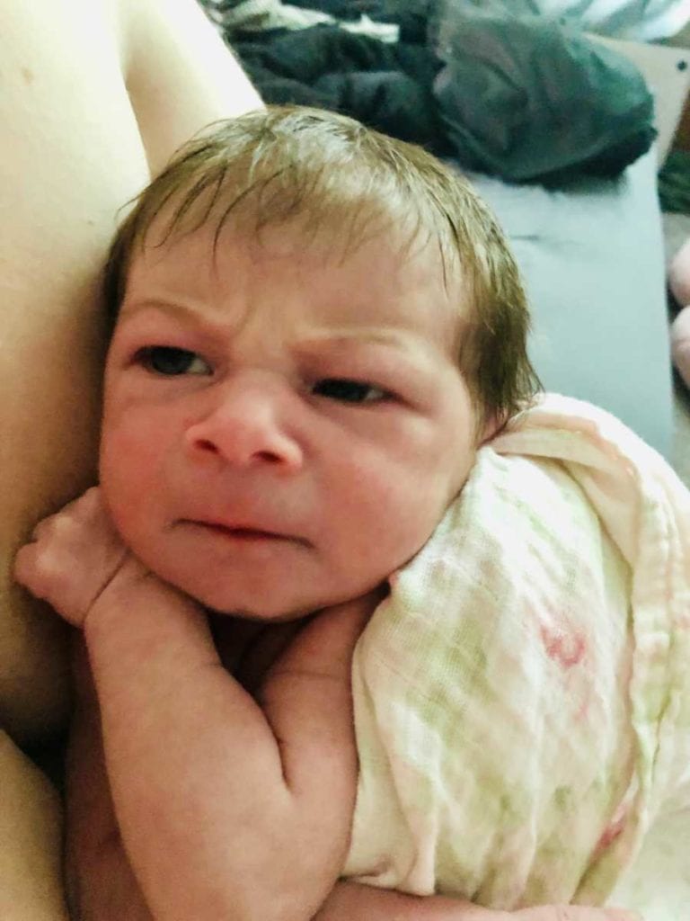 Baby girl born with a fixed "angry" expression is healthy after ...