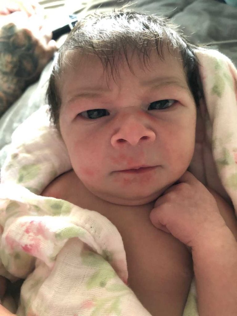Baby girl born with a fixed "angry" expression is healthy after ...