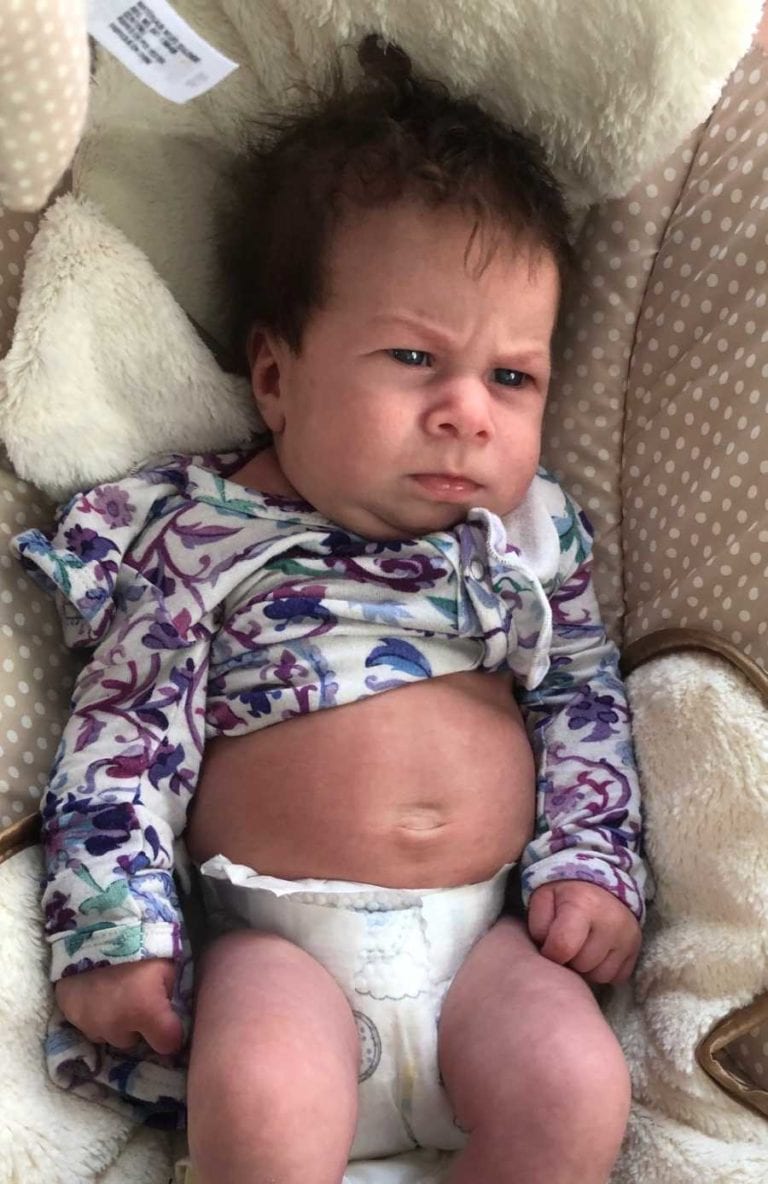 Baby girl born with a fixed "angry" expression is healthy after ...