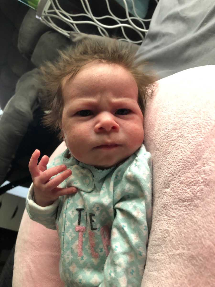 Baby girl born with a fixed "angry" expression is healthy after ...
