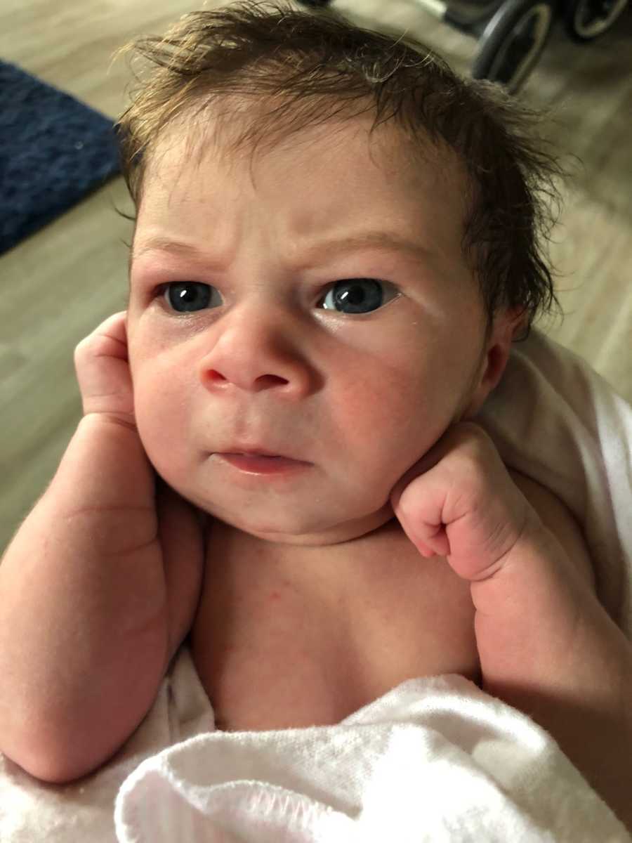Baby girl born with a fixed "angry" expression is healthy after ...