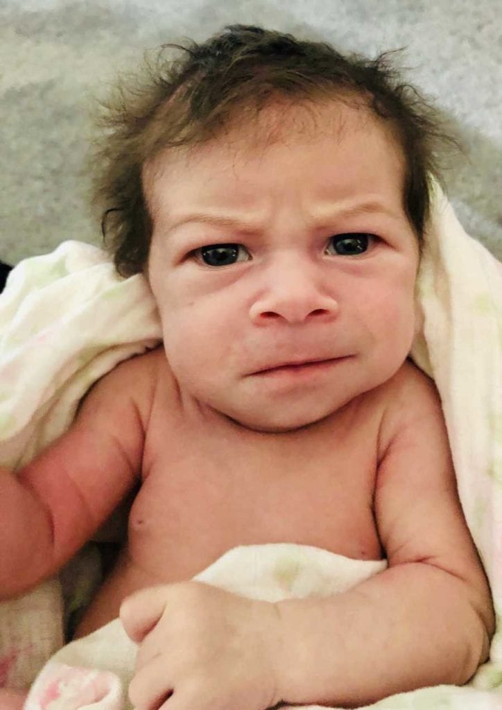 Baby girl born with a fixed "angry" expression is healthy after ...
