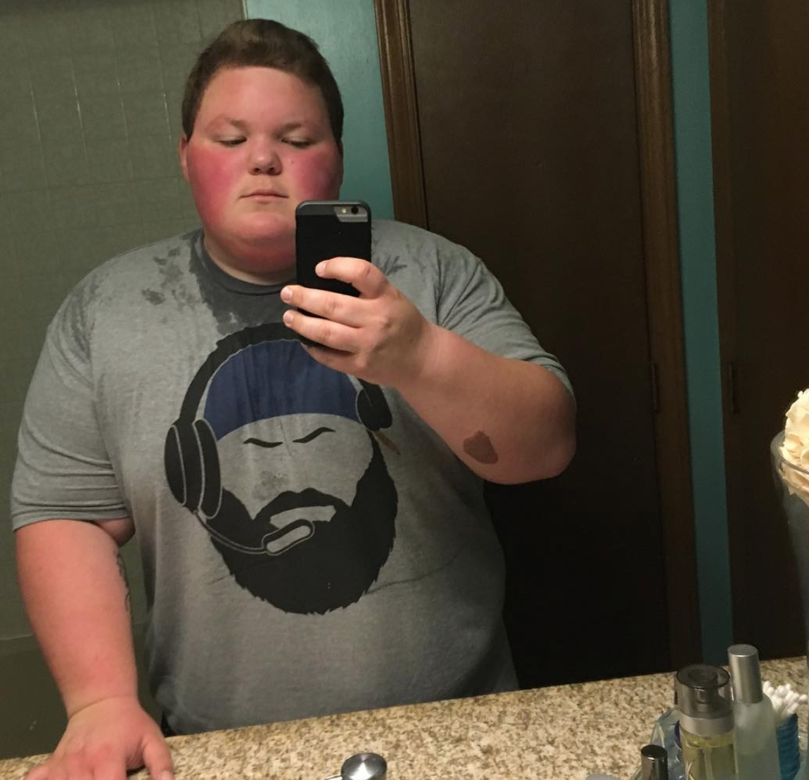 Overweight bullied boy unrecognizable after dropping 184 lbs