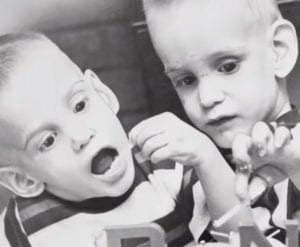 Oldest Living Conjoined Twins In The World Celebrate Birthday