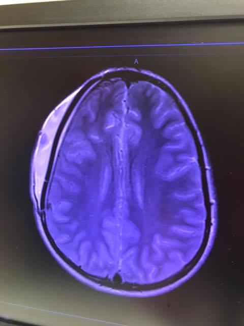 Teen with boat anchor lodged in head miraculously survives accident