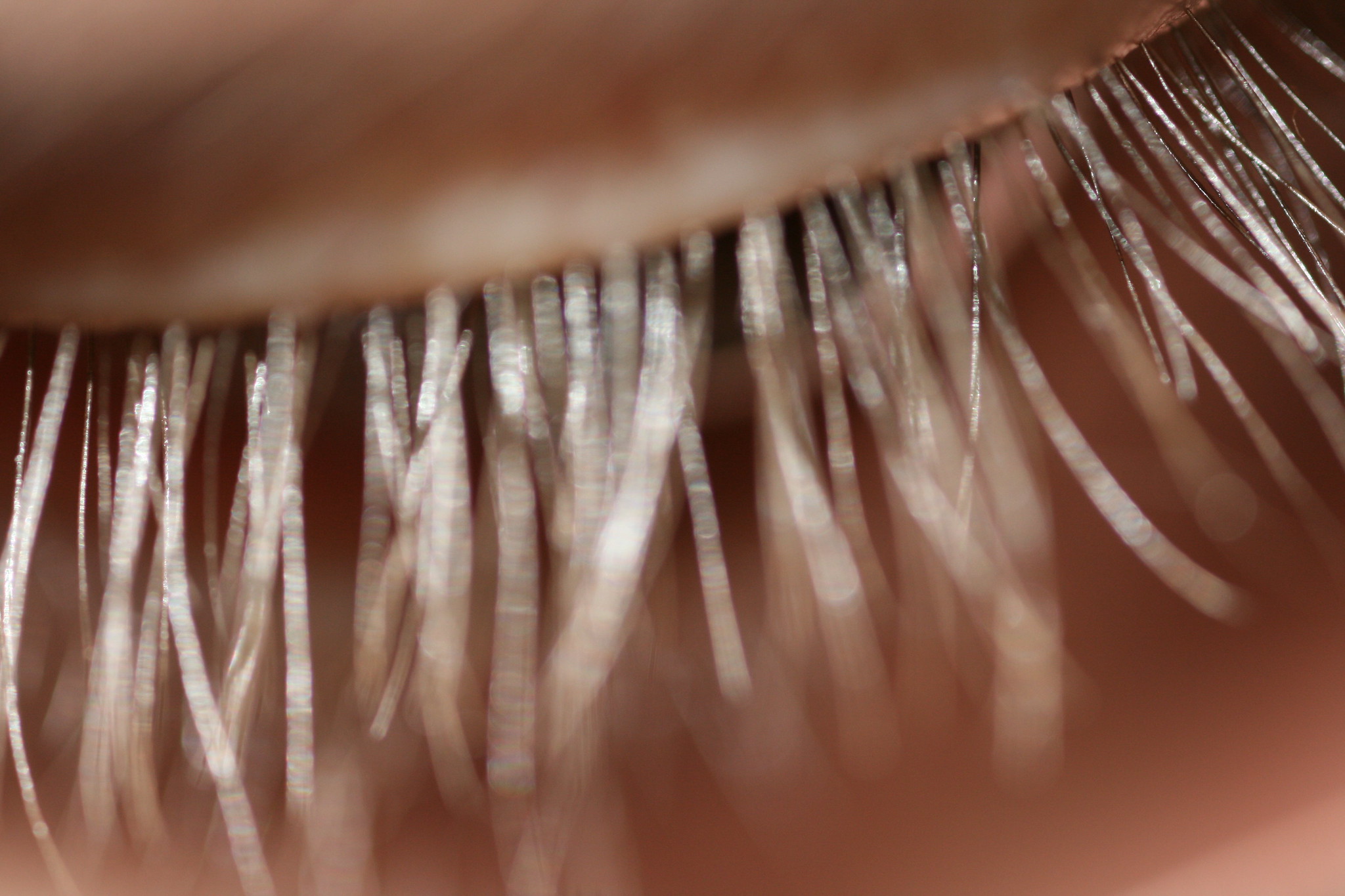 Lash lice becoming more common in eyelash extensions – some doctors are ...