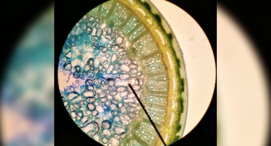 30 Normal things that look out of this world under a microscope