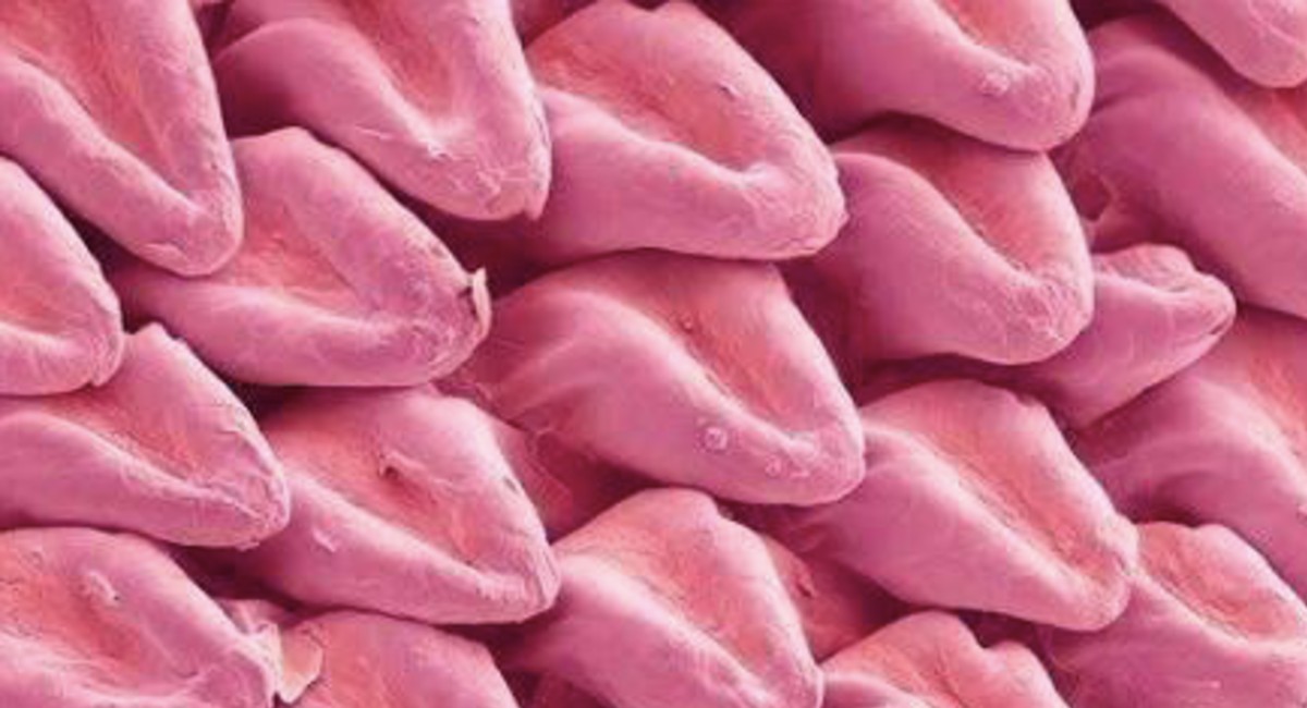 30 Normal things that look out of this world under a microscope