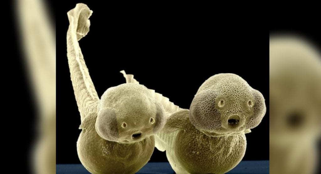 30 Normal things that look out of this world under a microscope