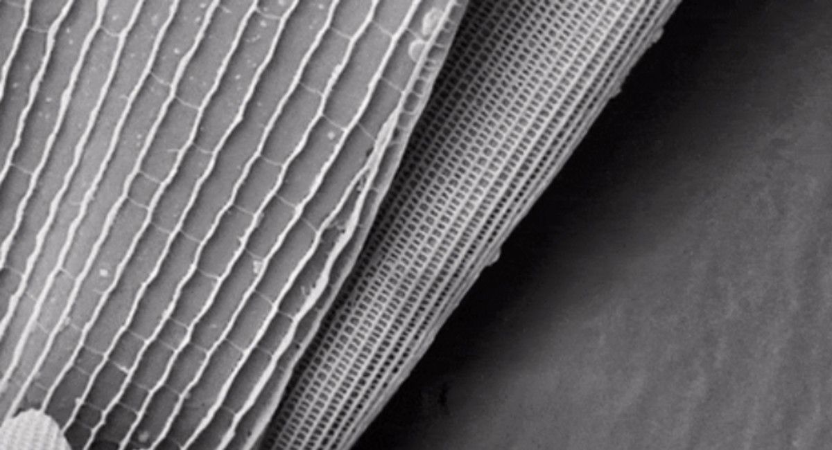 30 Normal things that look out of this world under a microscope