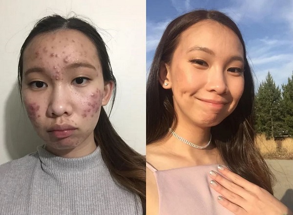 66 Things Changing Dramatically Over Time