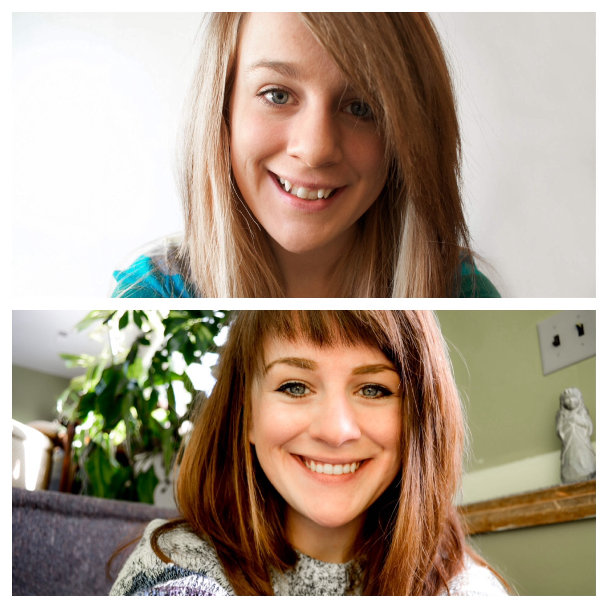 75 drastic transformations of people before and after braces