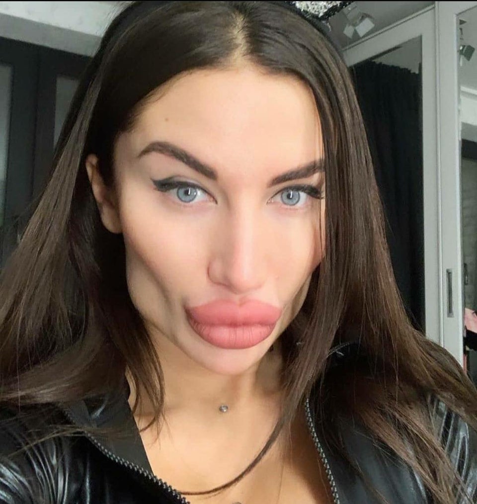 50 botched surgeries that went horribly wrong