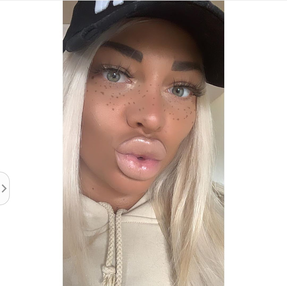 50 botched surgeries that went horribly wrong