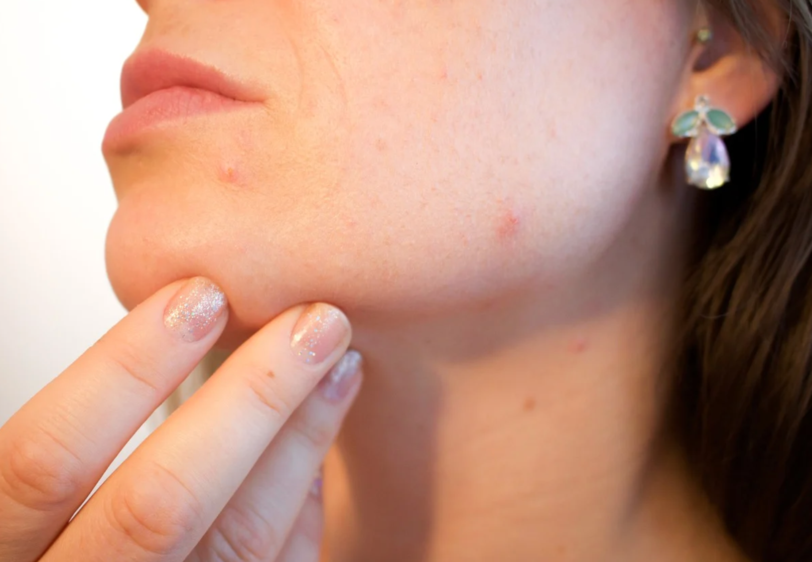 10+ Terrible skincare ideas people follow that make dermatologists cringe