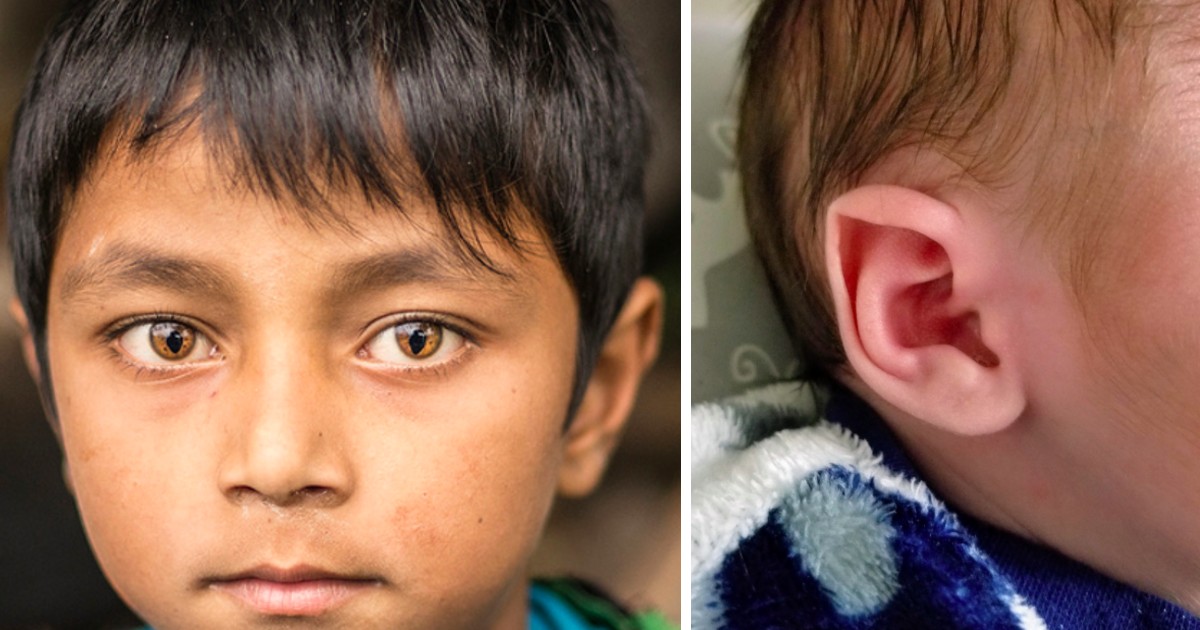 48 people with genetics that make them uniquely beautiful