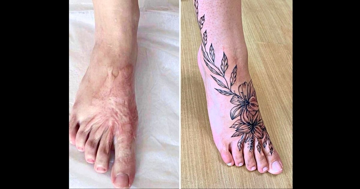 25 people who turned their scars into works of art