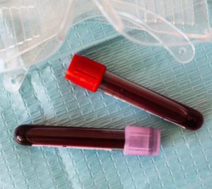 15 of the most common recessive genes in humans