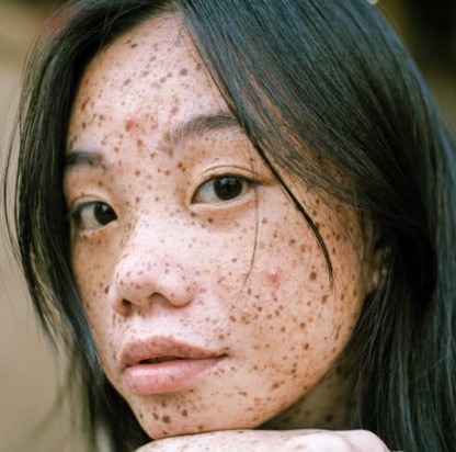 15 of the most common recessive genes in humans