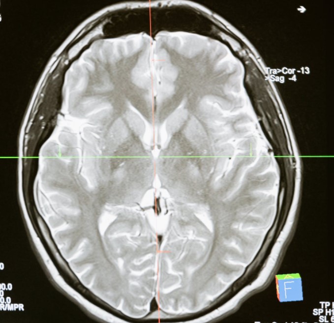 15 people with psychological afflictions that even doctors can’t explain